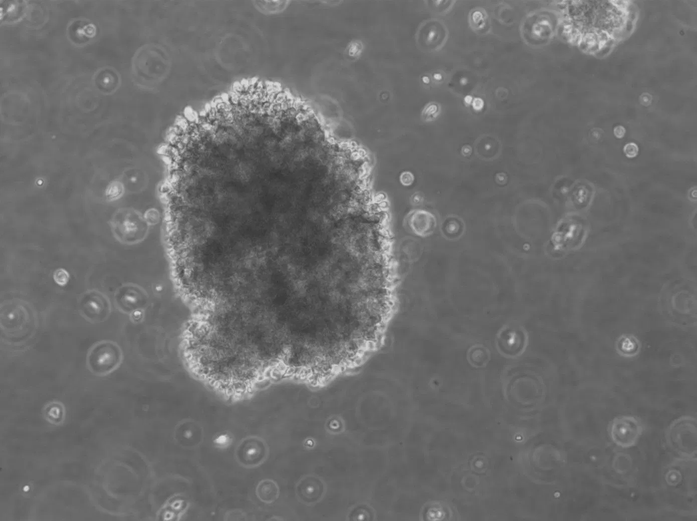 B-LCL-HROC102 Cells | Vivacell