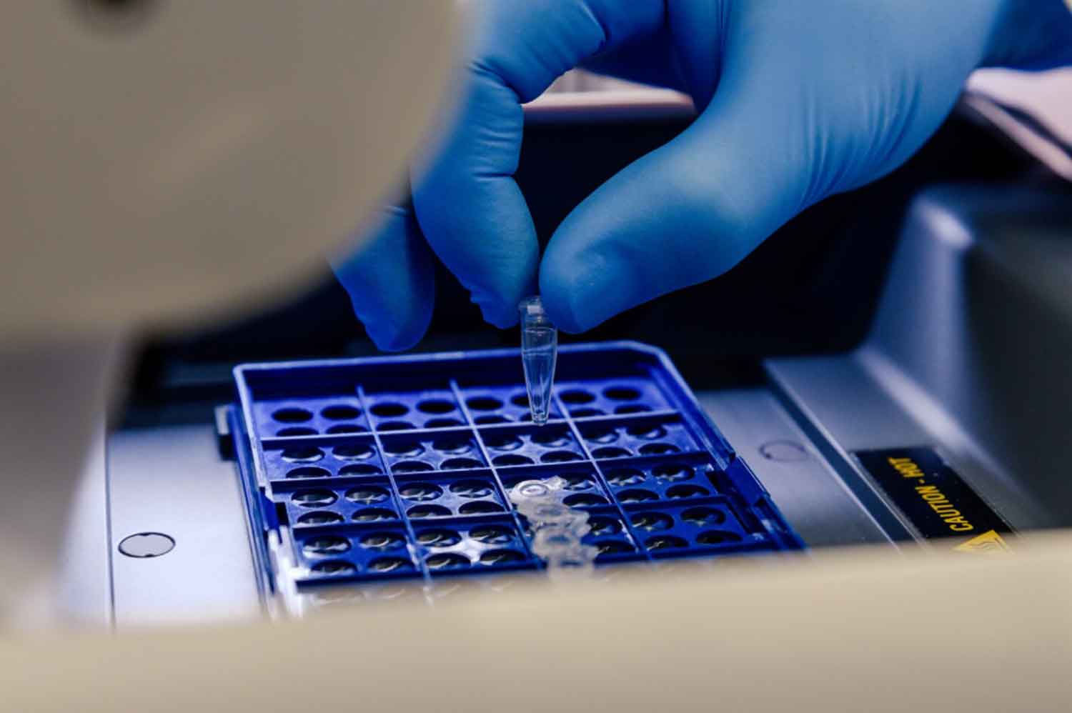 Why Fully Closed and Automated Bioreactors Are the Future of Clinical ...
